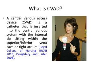 CVAD | PPTX