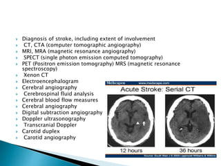 CVA MALARMATHI M.pptx