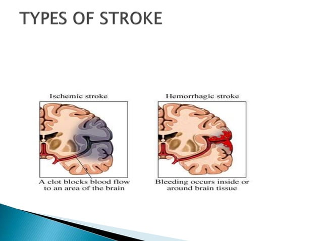 CVA MALARMATHI M.pptx