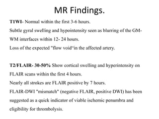 MRI in CVA | PPTX