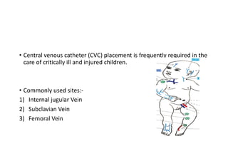 Cvc | PDF