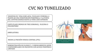 CVC.pptx