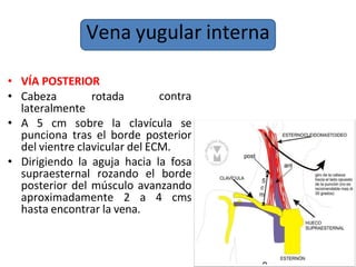 P CVC CATETER VENOSO CENTRAL PRESENTACION | PDF