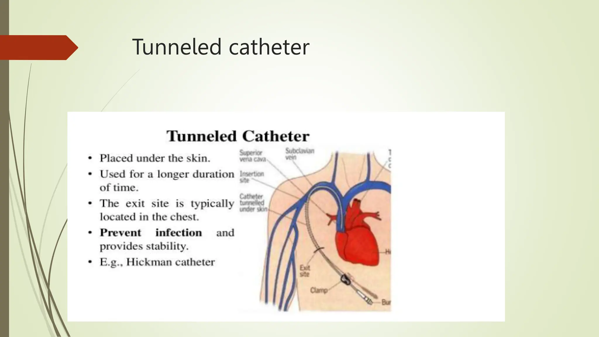 Central Venous Catheter Care - Central Line Associated Blood Stream ...