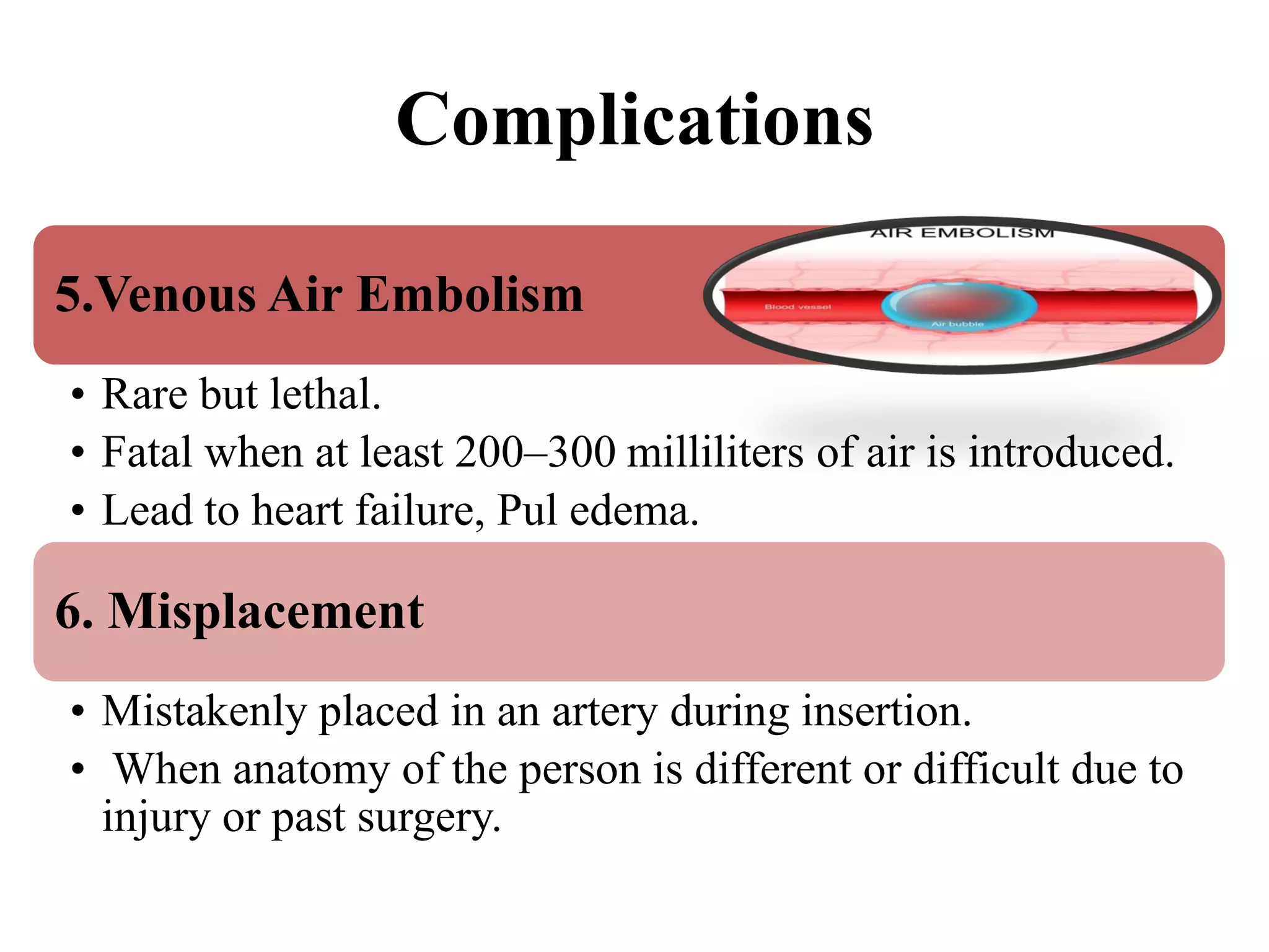 Central Venous Catheter Care- A Nursing skill | PDF