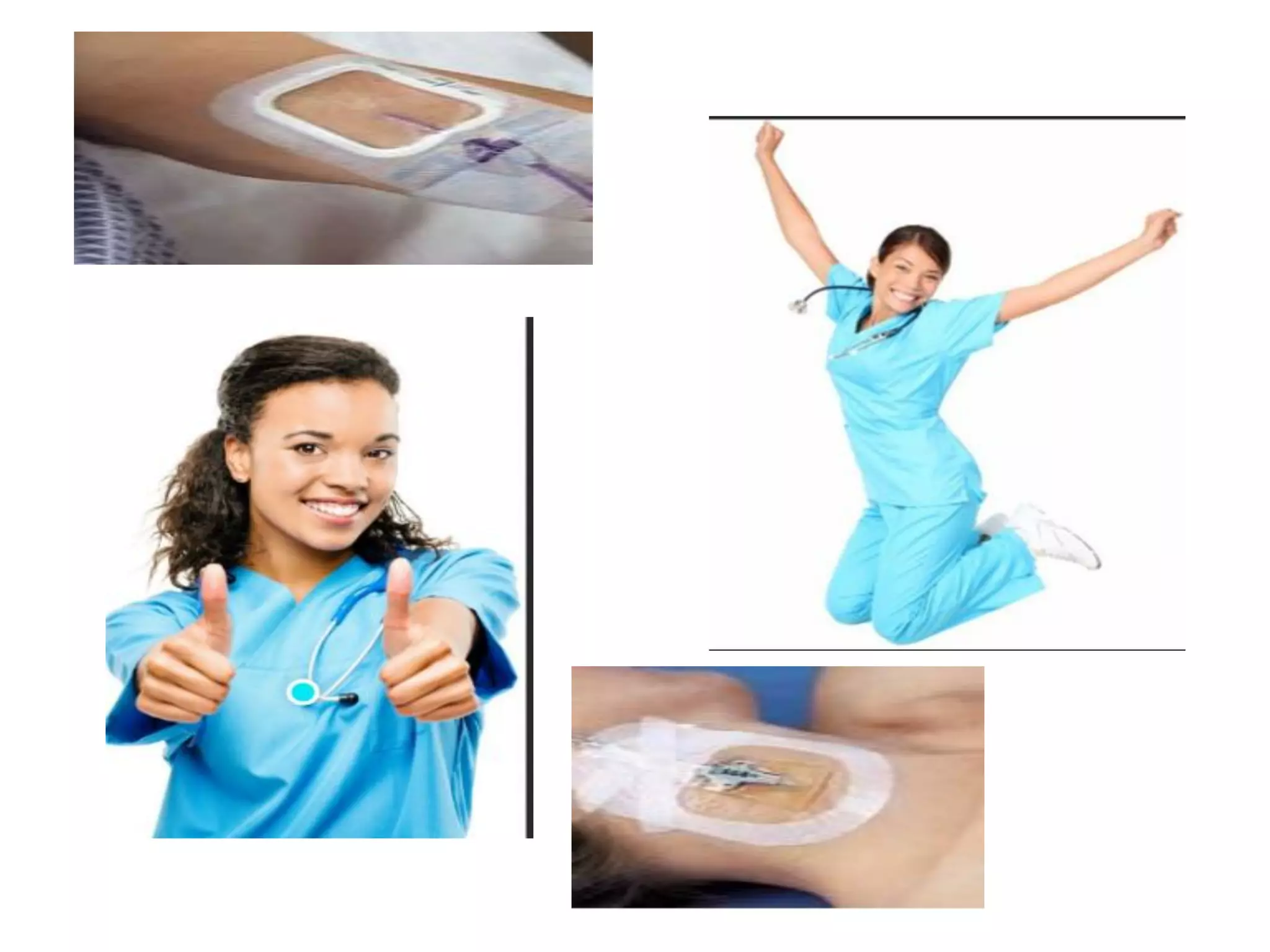Central Venous Catheter Care- A Nursing skill | PDF