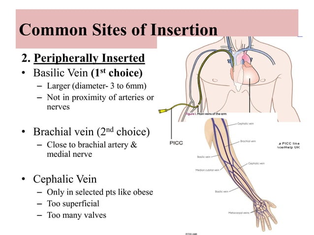 Central Venous Catheter Care- A Nursing skill | PDF