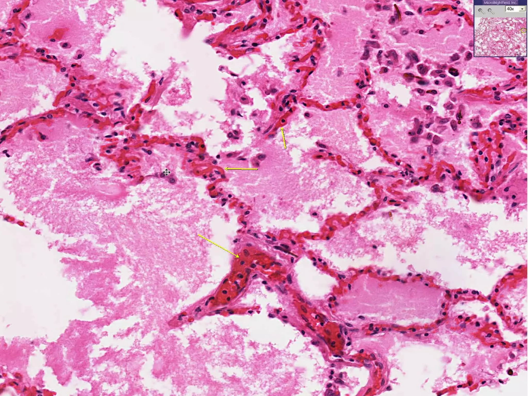 Cvc lung, liver and spleen | PPT