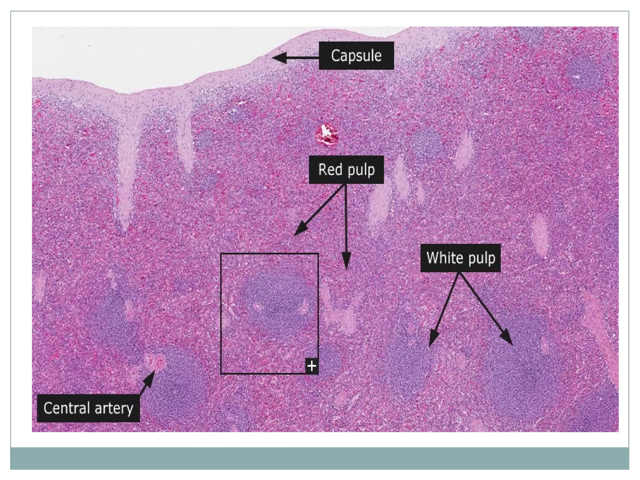 Cvc lung, liver and spleen | PPT