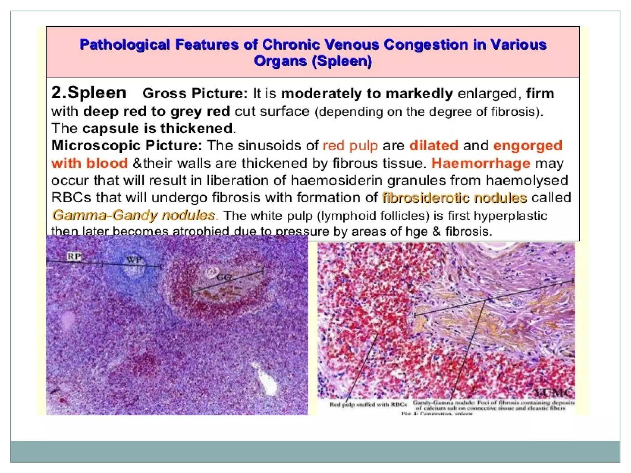 Cvc lung, liver and spleen | PPT