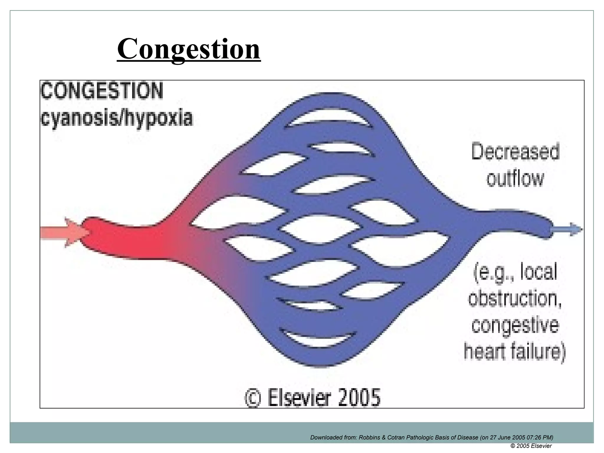 Cvc lung, liver and spleen | PPT