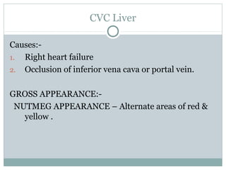 Cvc lung, liver and spleen | PPT