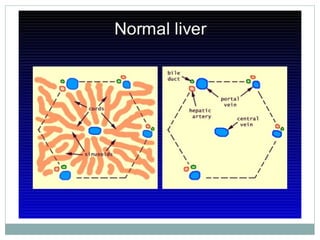 Cvc lung, liver and spleen | PPT