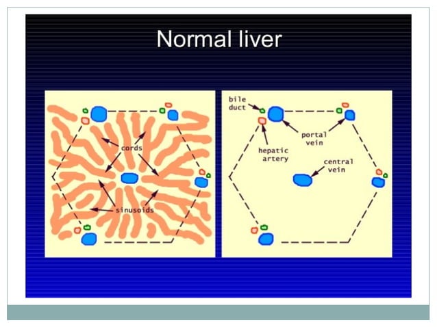 Cvc lung, liver and spleen | PPT | Heart and Cardiovascular Diseases ...