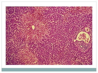 Cvc lung, liver and spleen | PPT