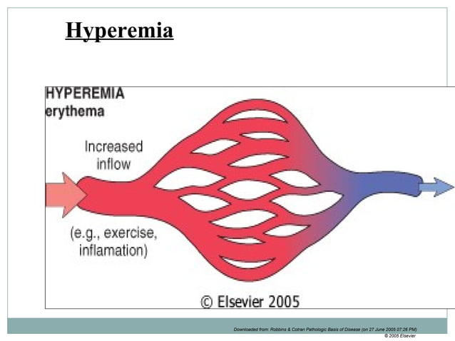 Cvc lung, liver and spleen | PPT | Heart and Cardiovascular Diseases ...