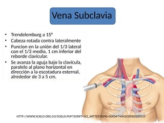 cateter venoso central por medicina familiar r1 | PPTX