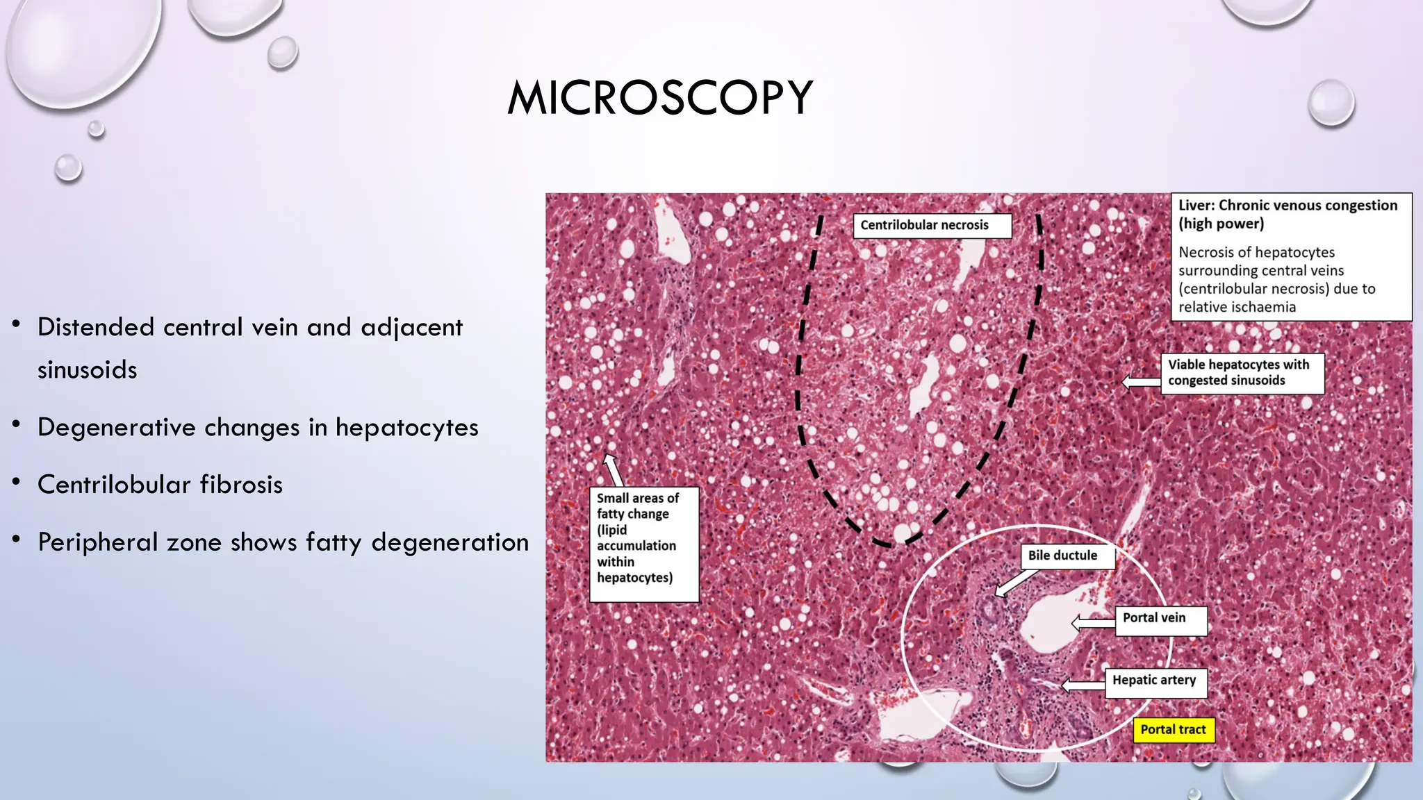 Chronic venous congestion if spleen powerpoint | PPTX