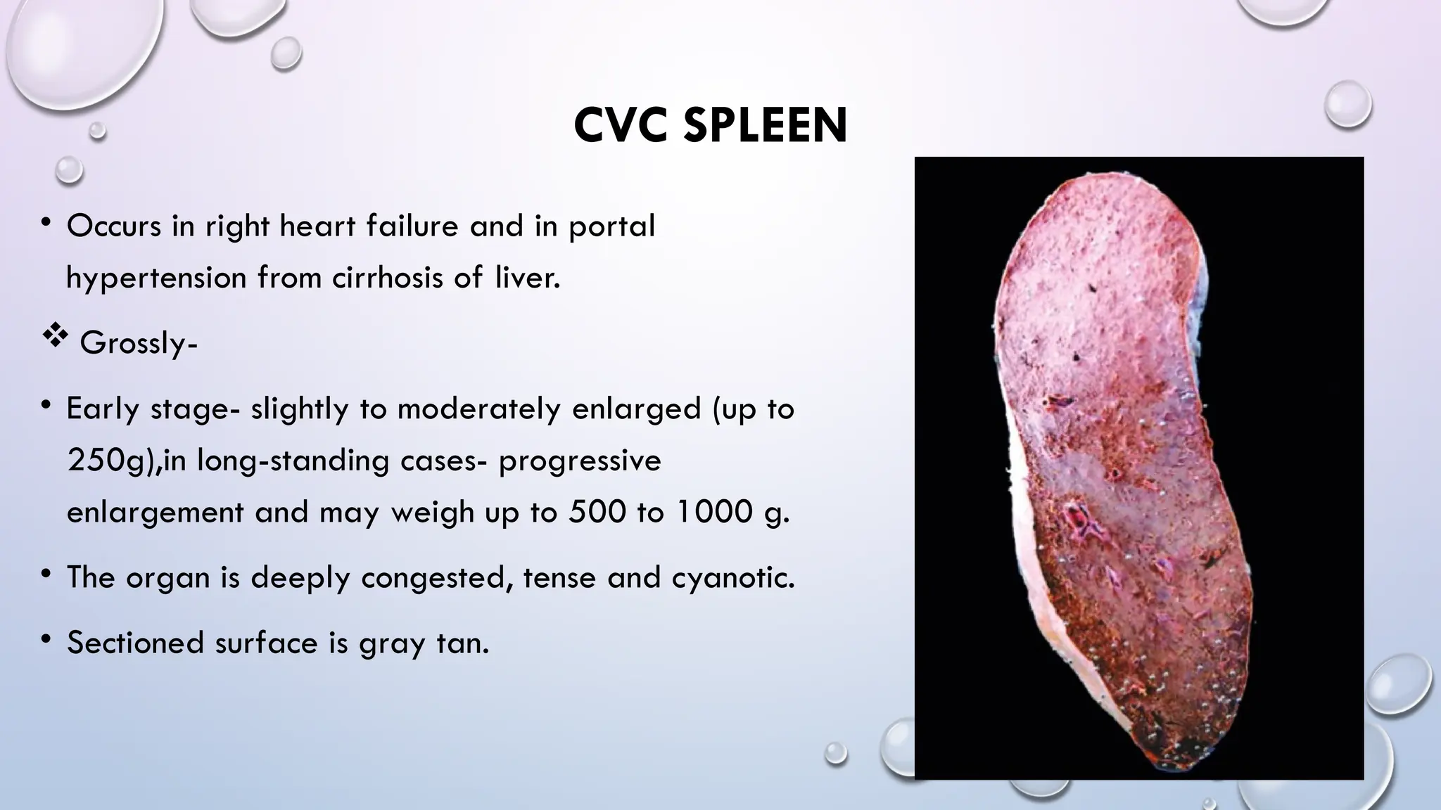 Chronic venous congestion if spleen powerpoint | PPTX