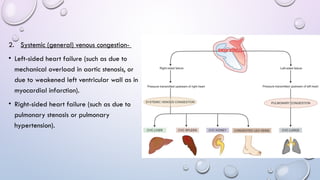 Chronic venous congestion if spleen powerpoint | PPTX