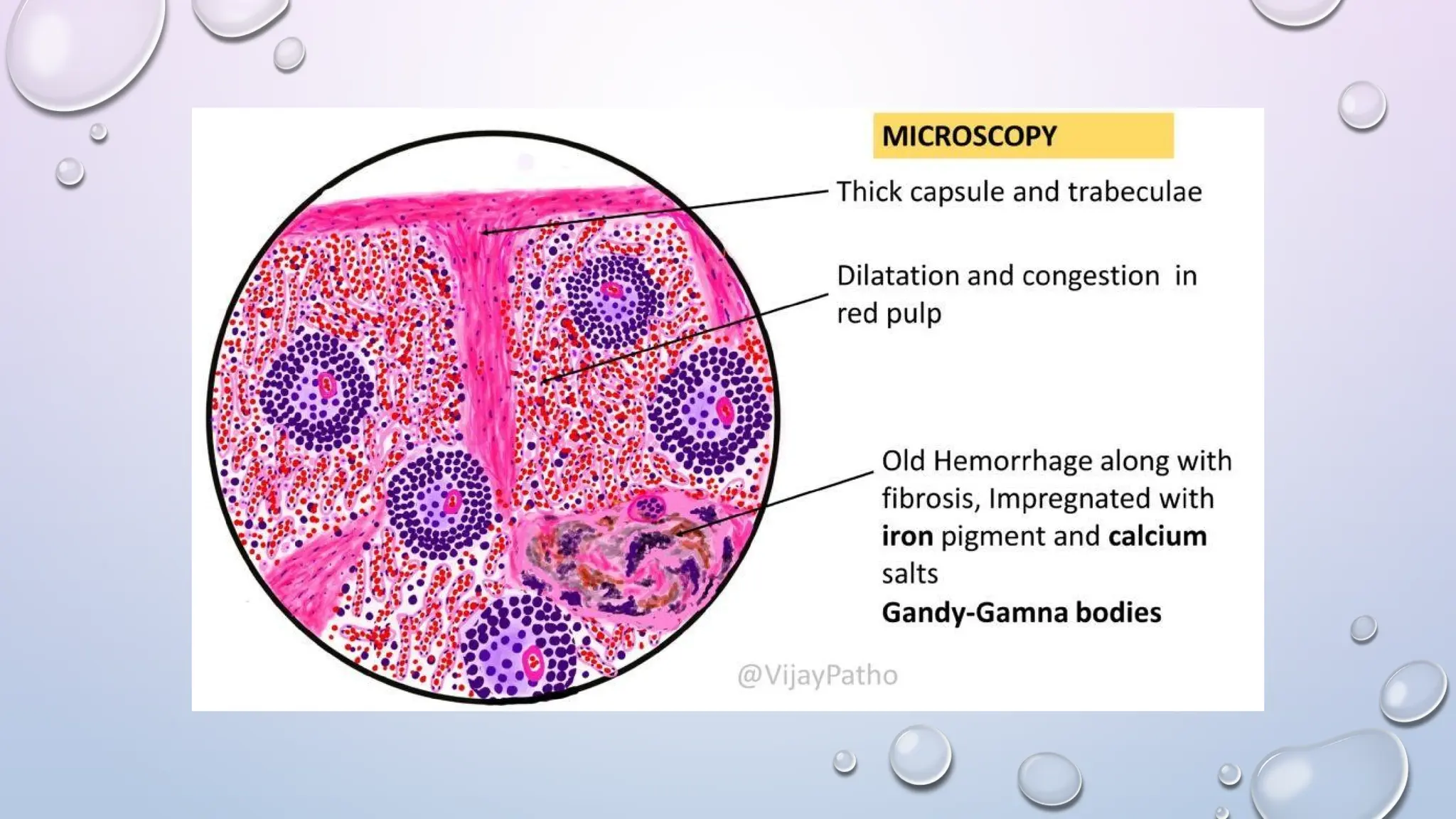 CVC spleen for 2nd year mbbs students pathology | PPTX