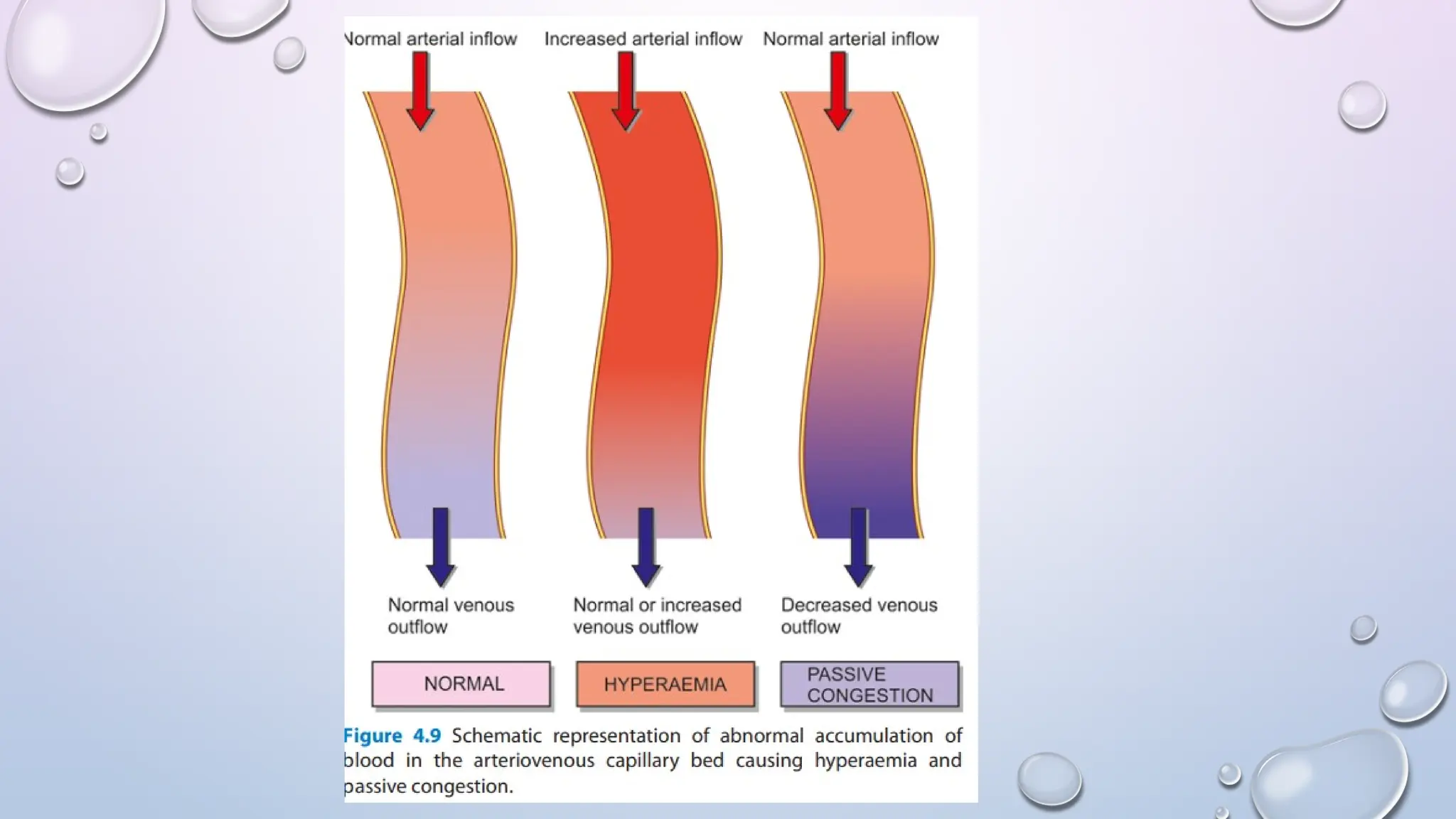 CVC spleen for 2nd year mbbs students pathology | PPTX