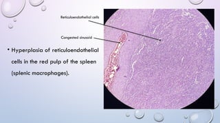 CVC spleen for 2nd year mbbs students pathology | PPTX