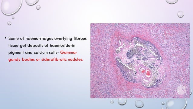 CVC spleen for 2nd year mbbs students pathology | PPTX