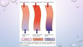 CVC spleen for 2nd year mbbs students pathology | PPTX