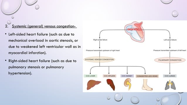 CVC spleen for 2nd year mbbs students pathology | PPTX
