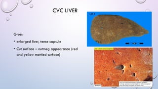CVC spleen for 2nd year mbbs students pathology | PPTX