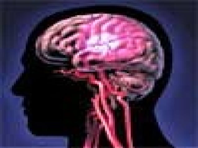 Cerebrovascular disease | PPT
