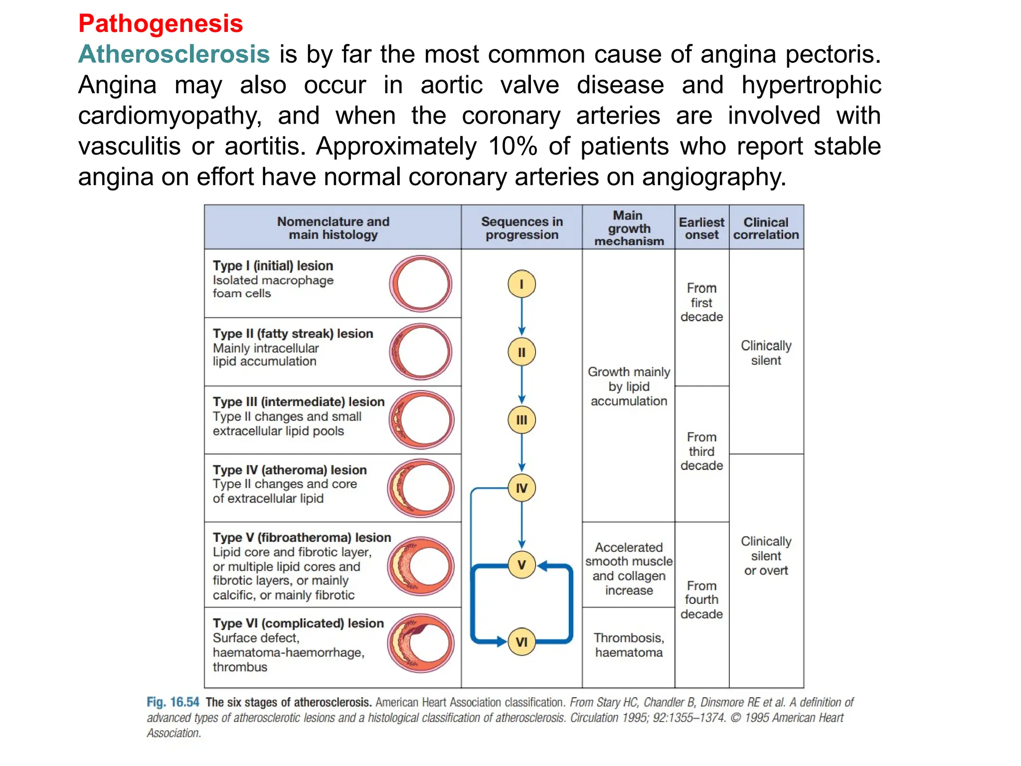 CVD........................... LEC4.pptx