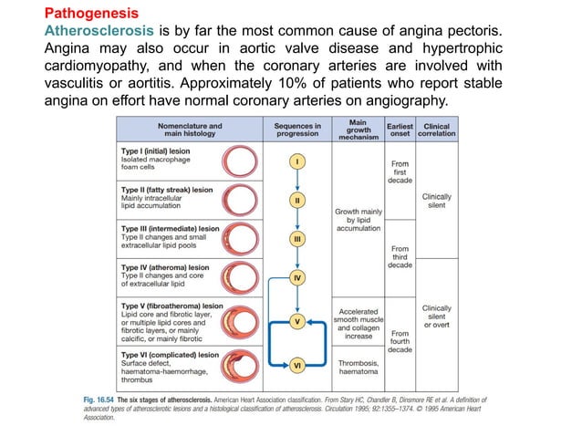 CVD........................... LEC4.pptx
