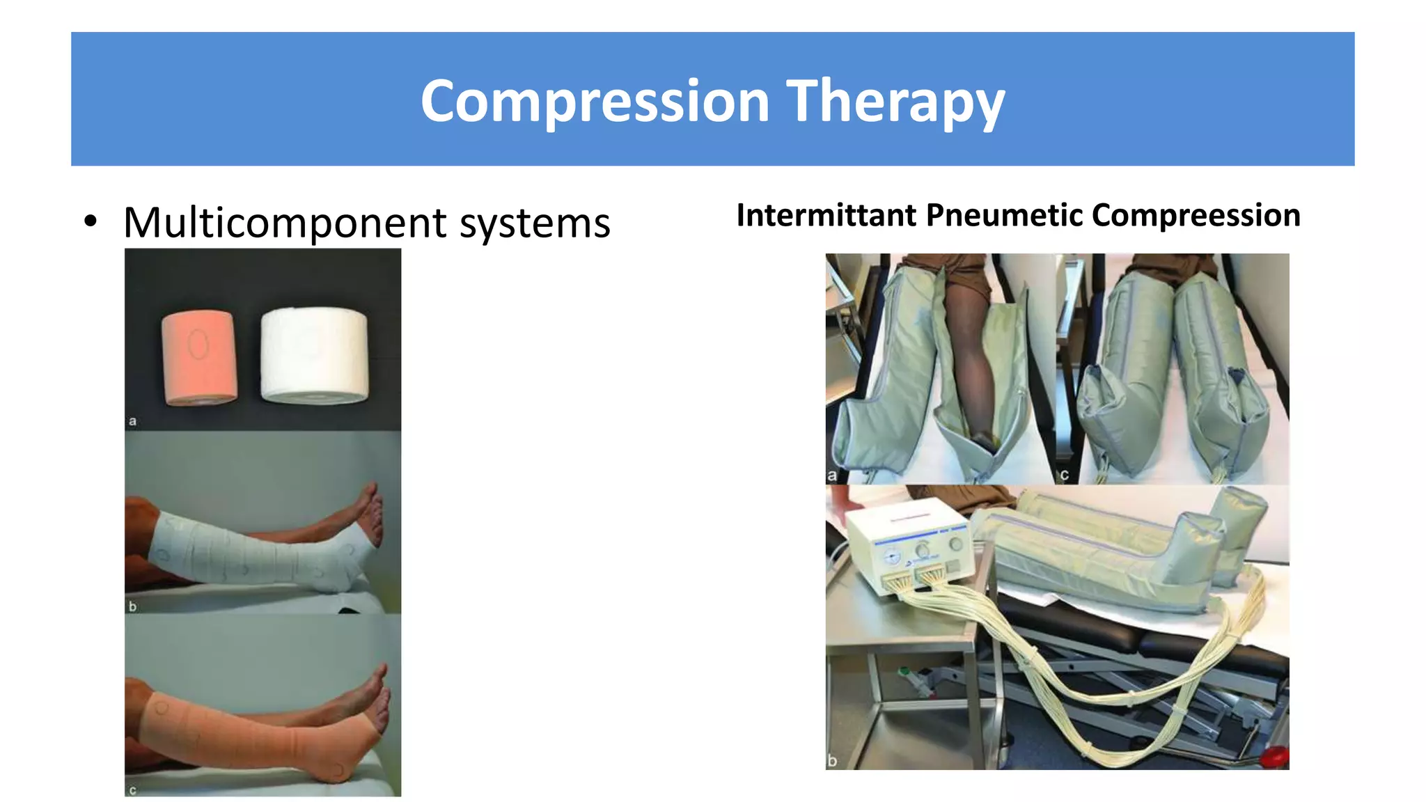CHRONIC VENOUS DISEASE: From pathogenesis to clinicals | PPTX