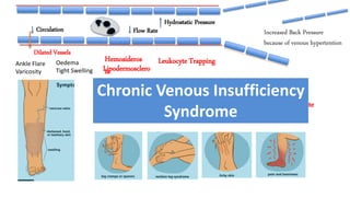 CHRONIC VENOUS DISEASE: From pathogenesis to clinicals | PPTX