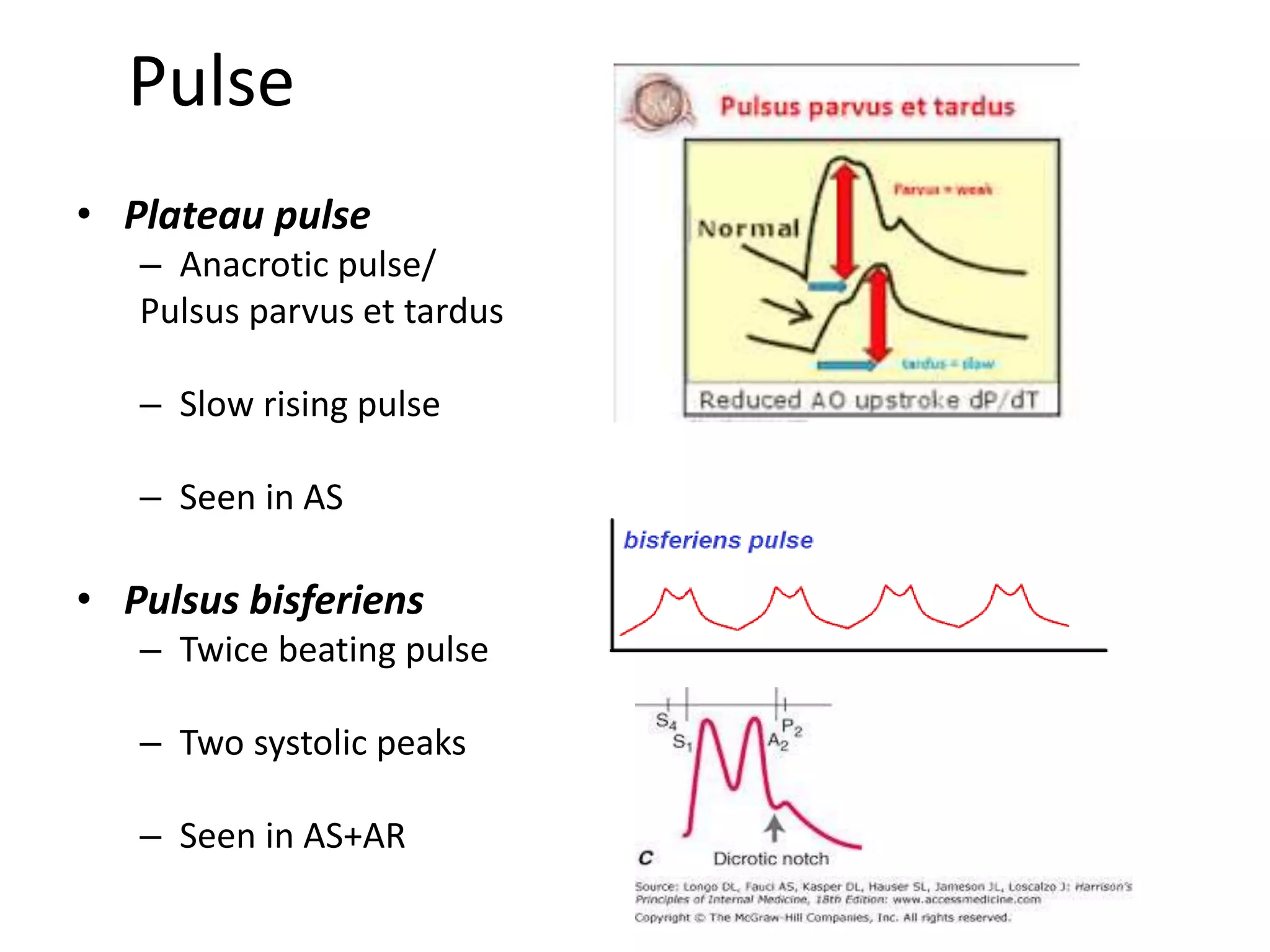 Cvd signs and symptoms | PPTX