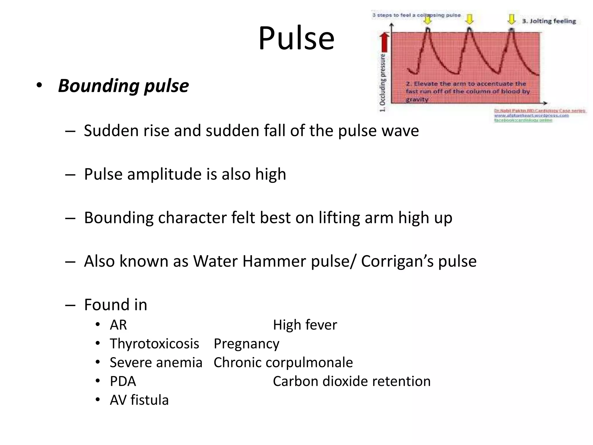 Cvd signs and symptoms | PPTX