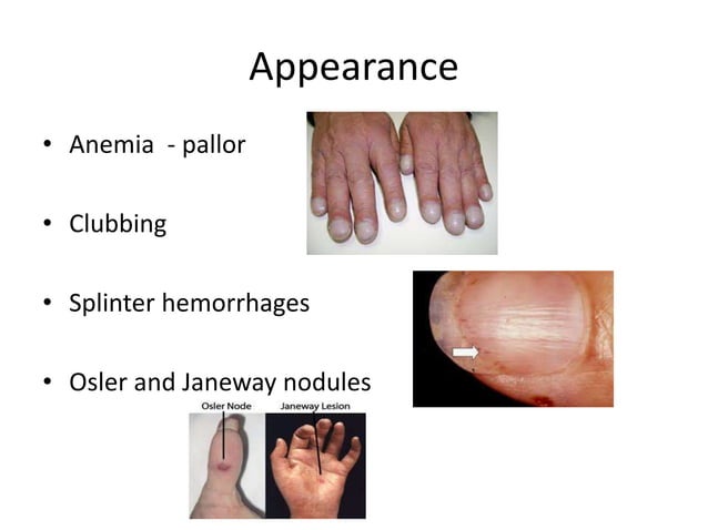 Cvd signs and symptoms | PPTX | Lung and Respiratory Health | Diseases ...