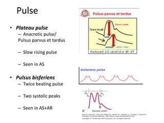 Cvd signs and symptoms | PPTX