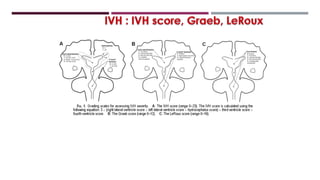 stroke score presentations ............. | PDF