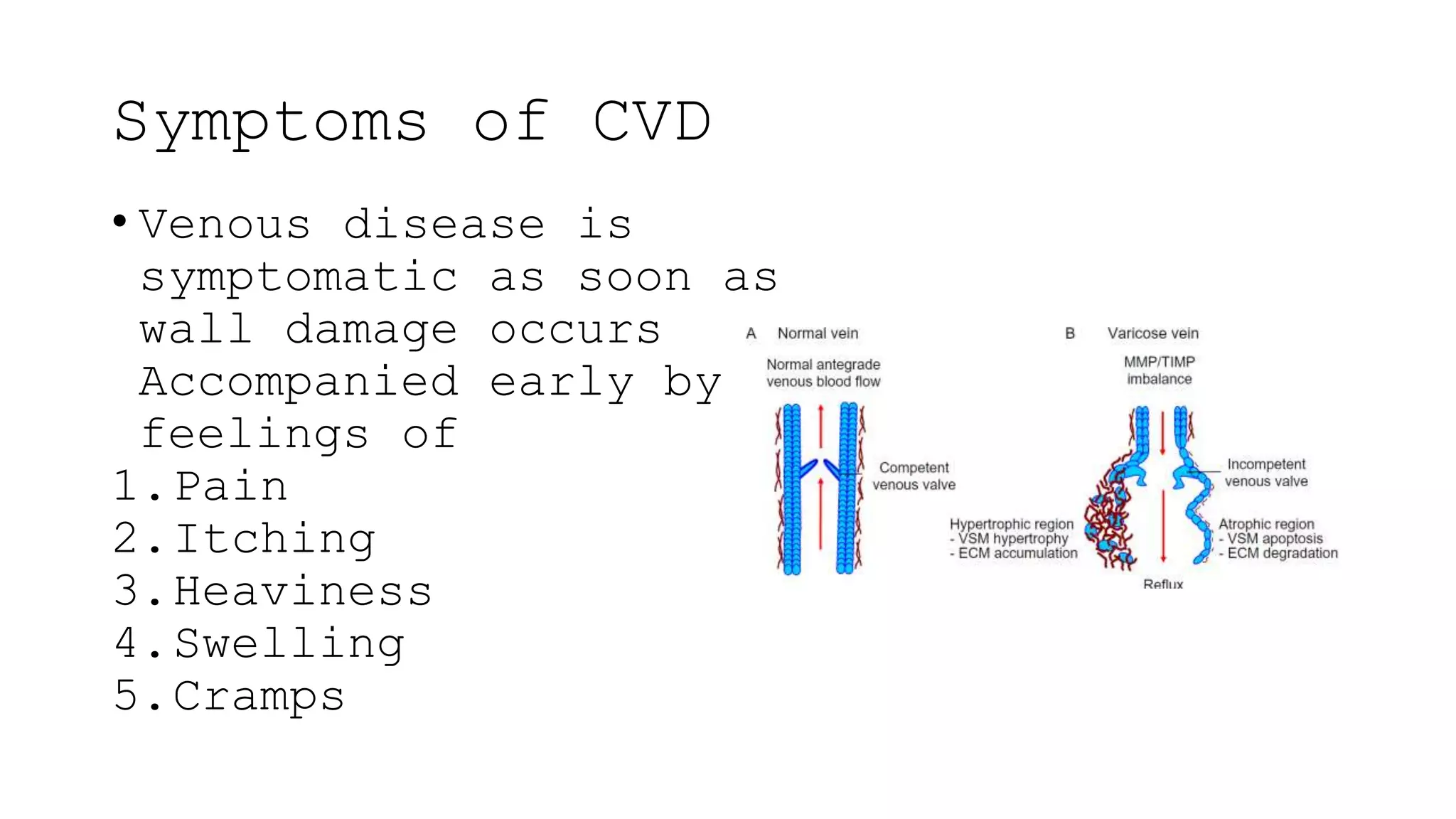 Chronic Venous insufficiency Overview.pptx