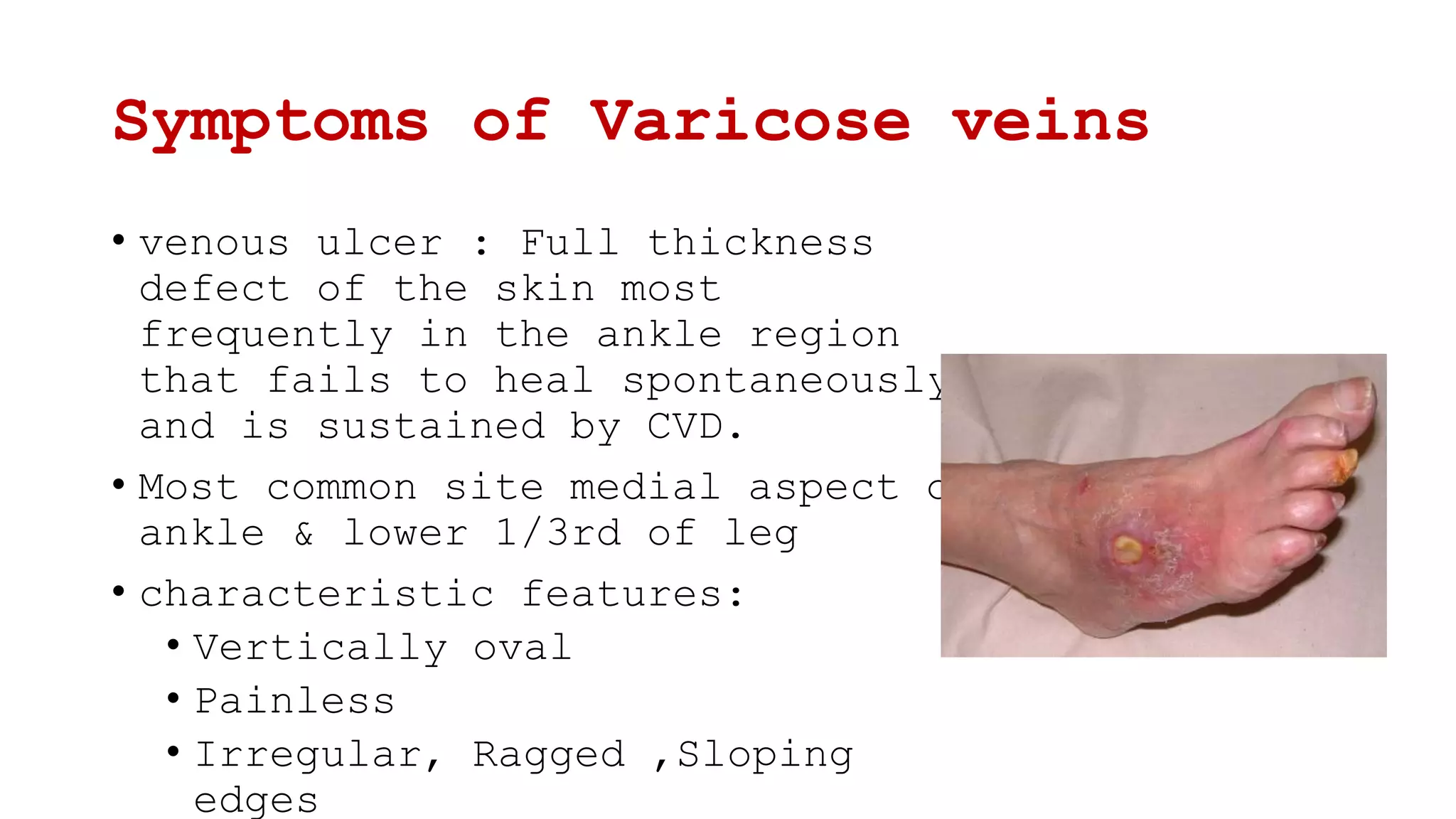 Chronic Venous insufficiency Overview.pptx