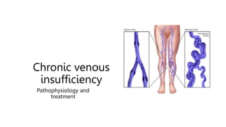 Chronic Venous insufficiency Overview.pptx