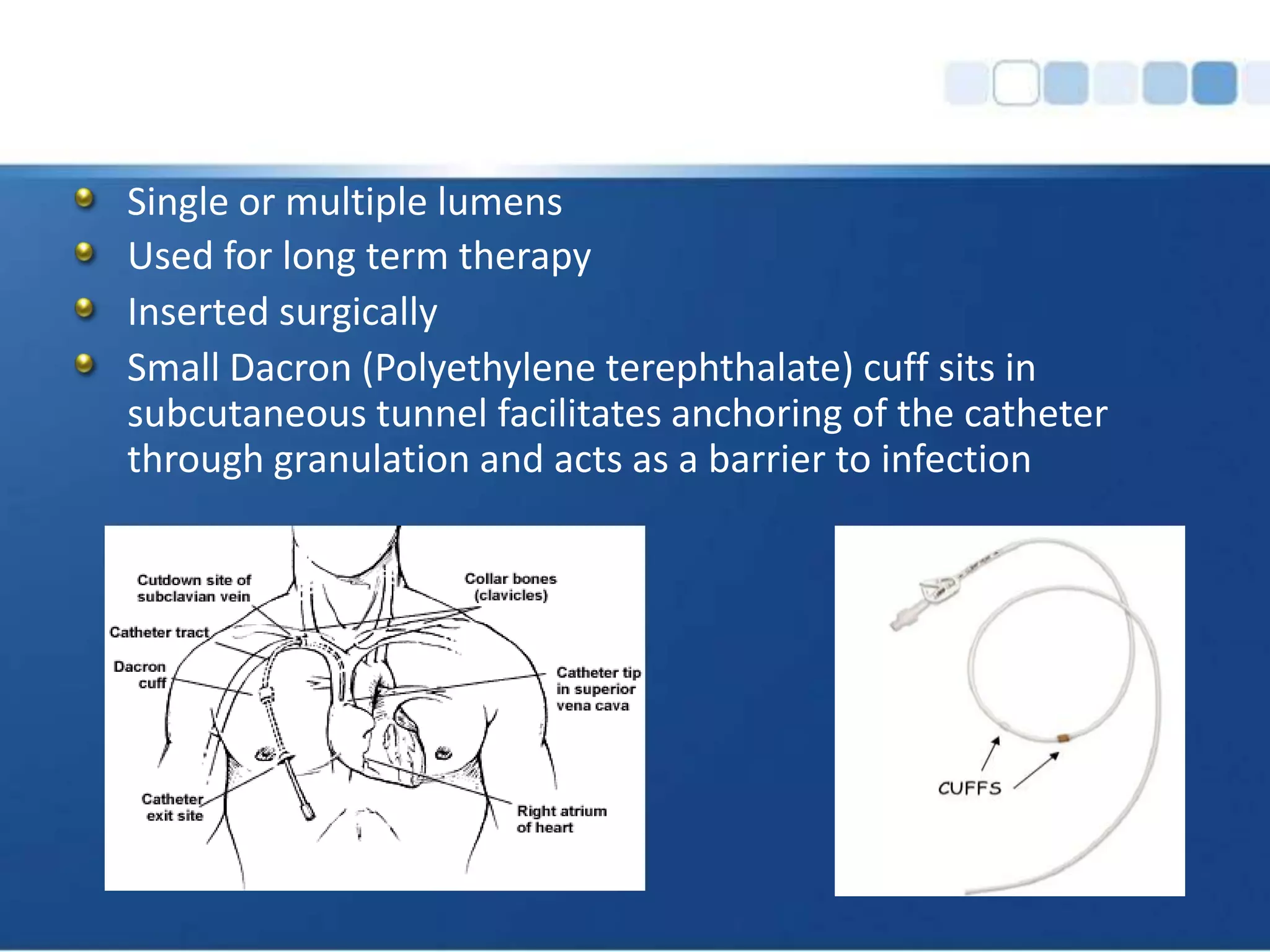 Central Venous Access | PPTX