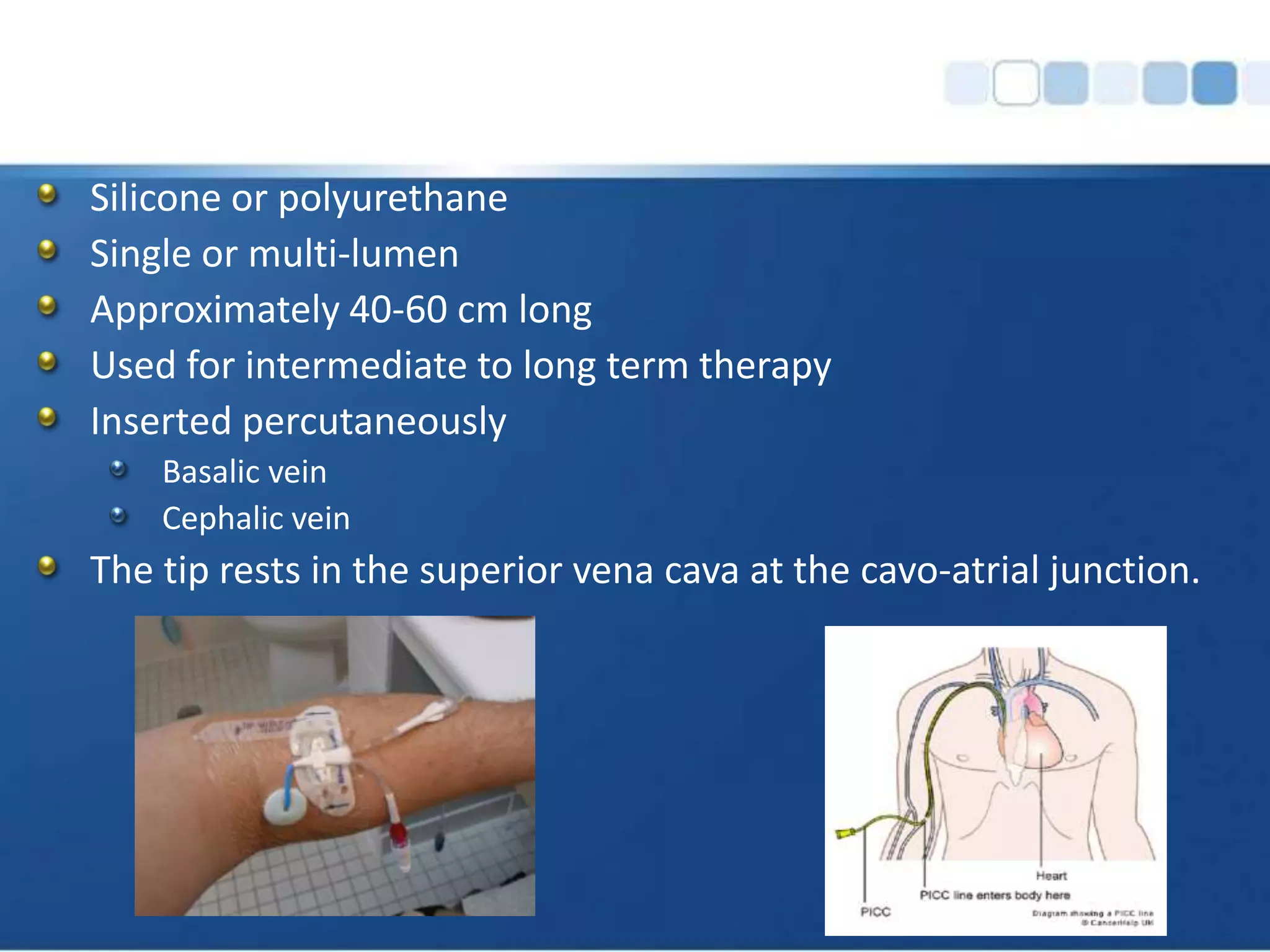 Central Venous Access | PPTX