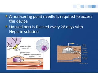Central Venous Access | PPTX