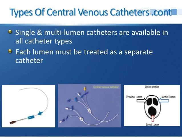 Central Venous Access