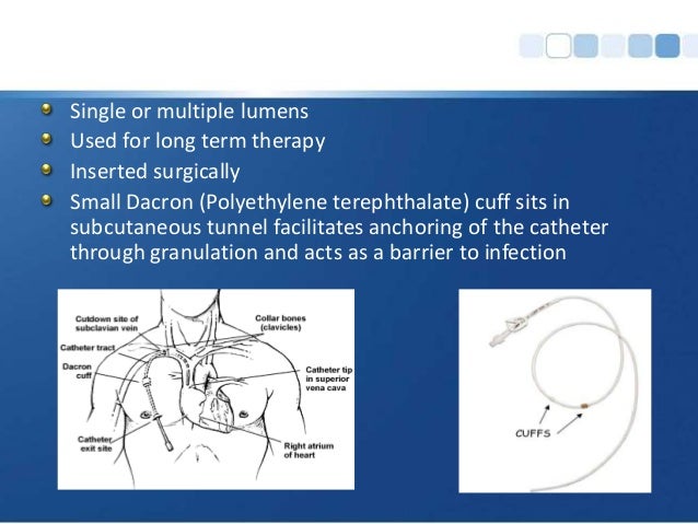 Central Venous Access