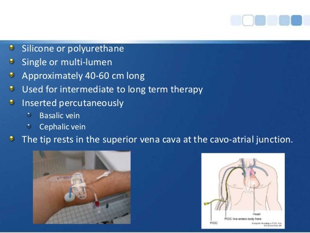 Central Venous Access